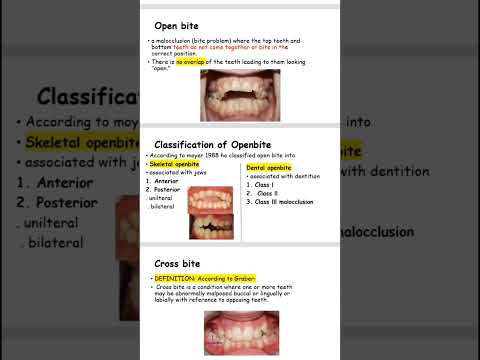 orthodontics basic terms on YouTube Now ▶️ dr#dentistry #dentistryworld #dentistry #malocclusion