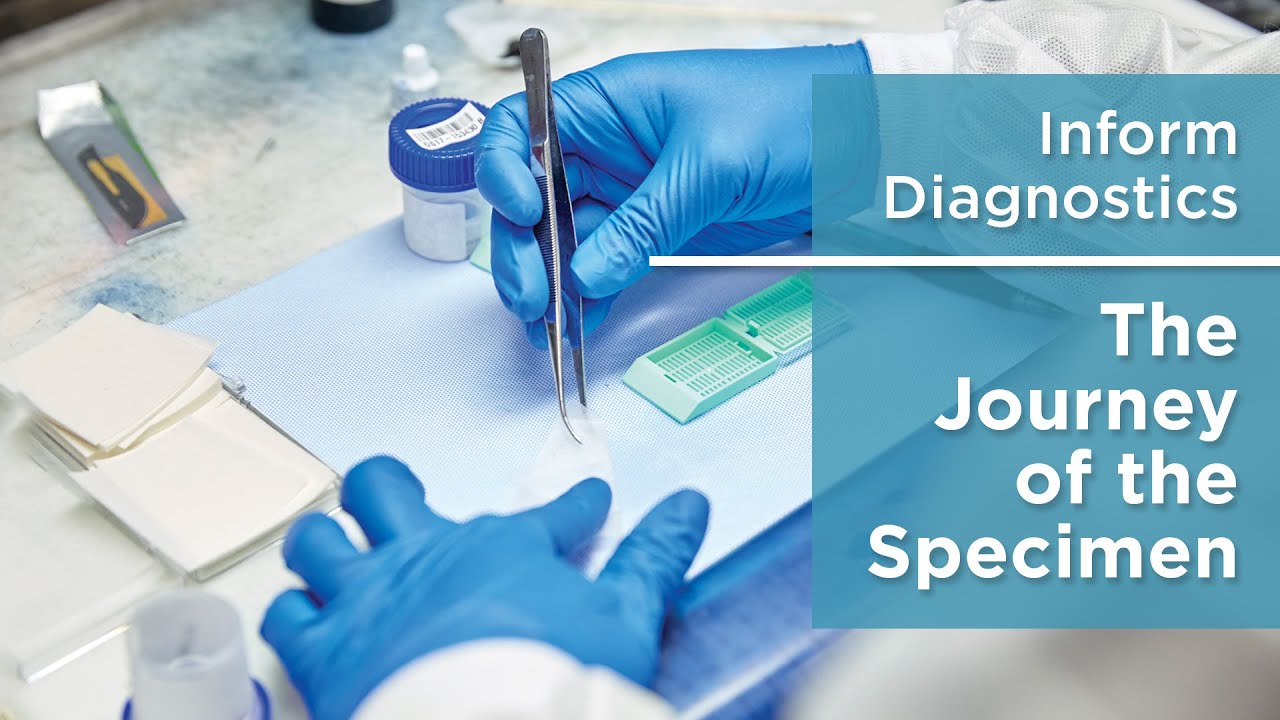 The Journey of the Specimen - Inform Diagnostics, 2023