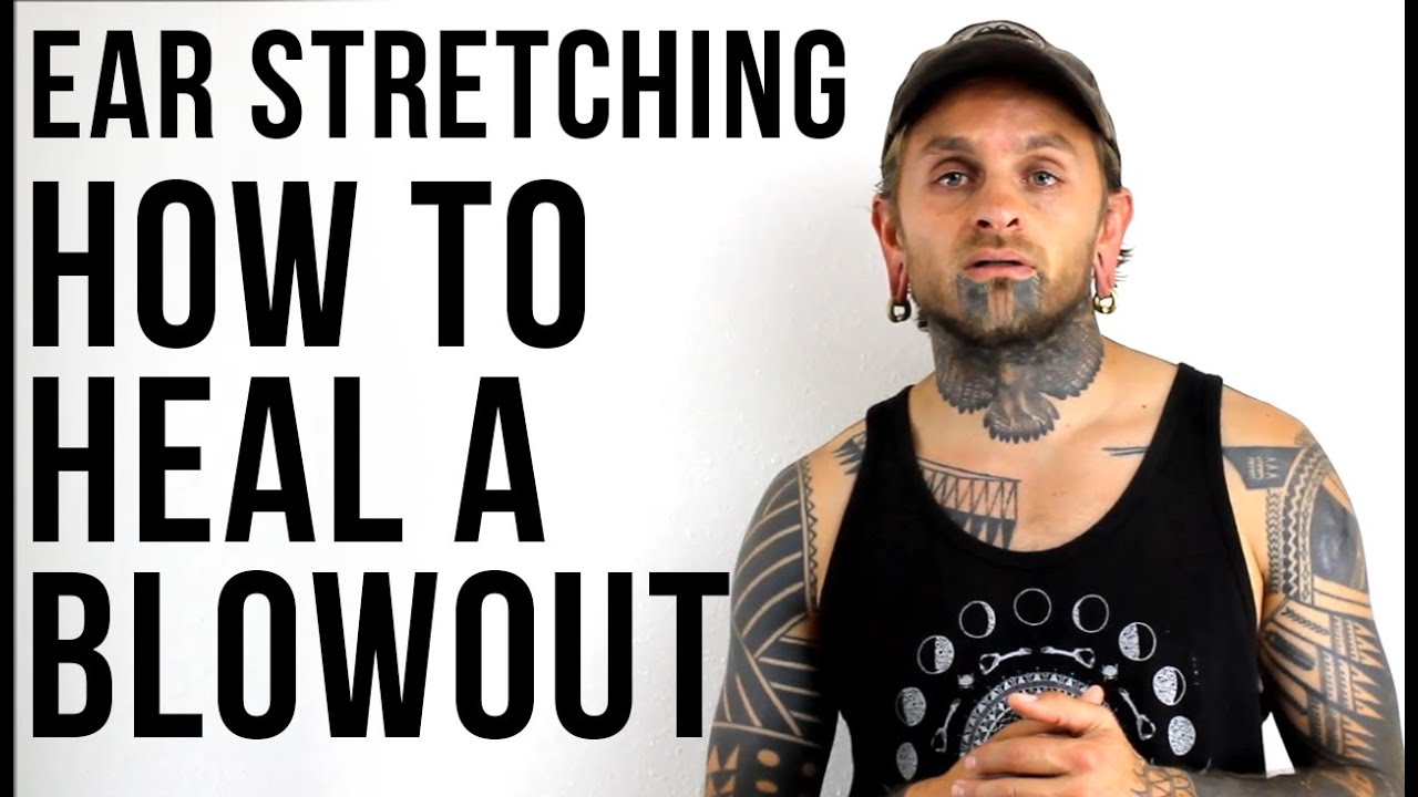 Ear Stretching Blowouts! How to Heal & Prevent Them | UBJ.com