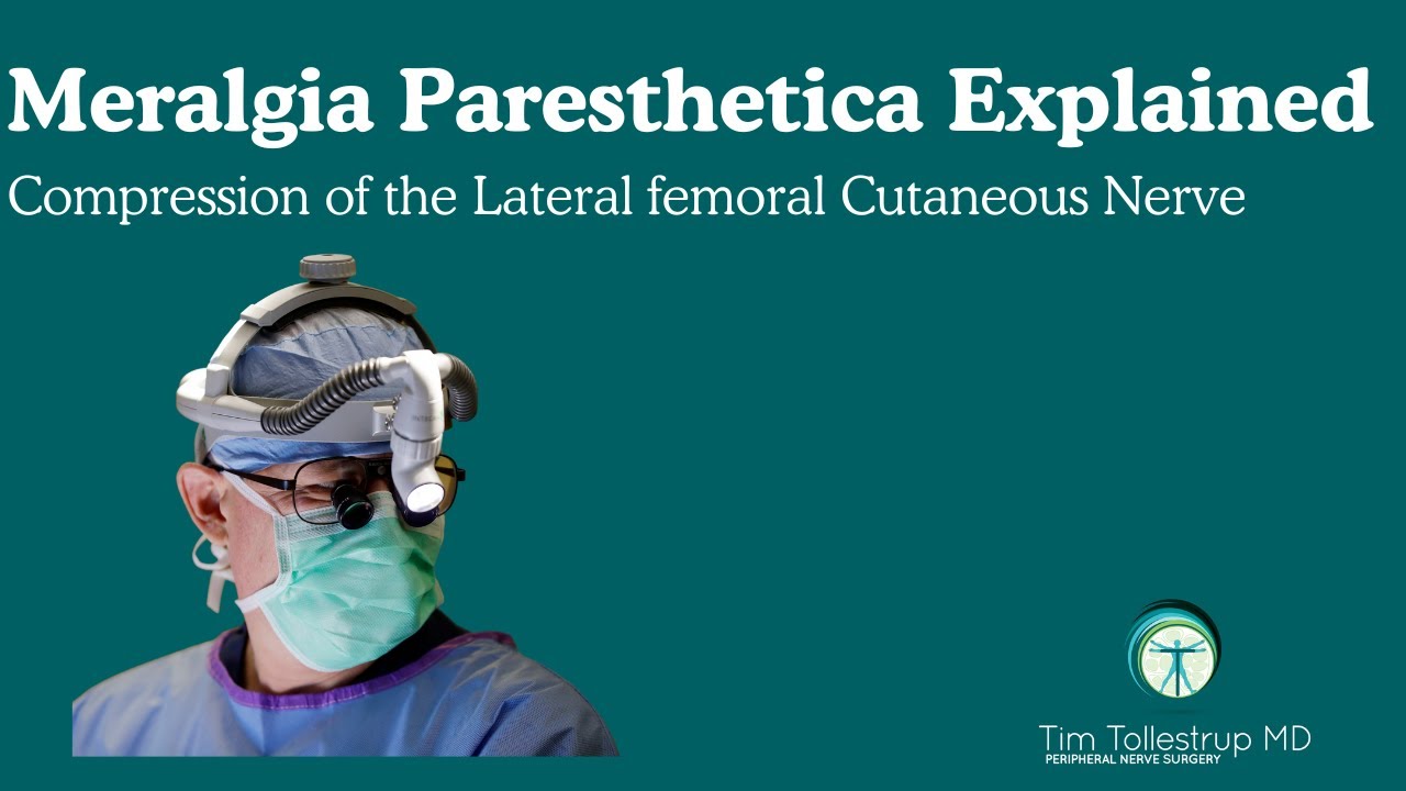 Meralgia Paresthetica: Understanding Treatment for Nerve Compression Syndrome