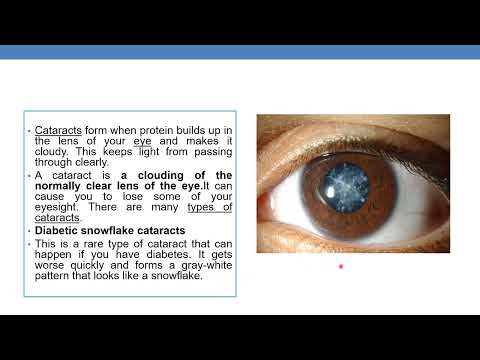 HOW TO SEARCH ICD 10 CM CODE - 2