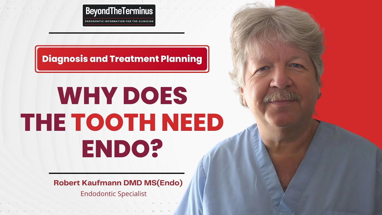 Root Canal or Extraction? How Dentists Decide