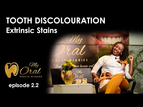 TOOTH DISCOLOURATION: Extrinsic stains