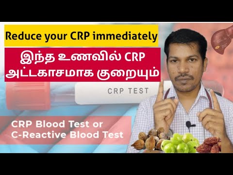 CRP lowering foods | CRP குறைக்கும் உணவுகள்| Dr Merish