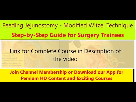 Feeding Jejunostomy- Complete Guide. (FJ & TG Series Part 3/3). ( See Video Description for Details)