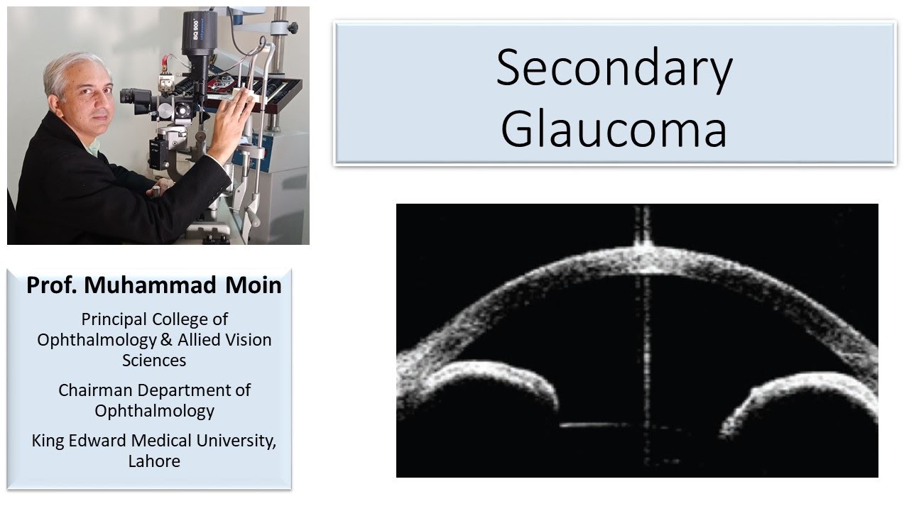 Eye Lectures: Secondary Glaucomas