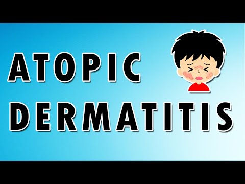 Atopic Dermatitis