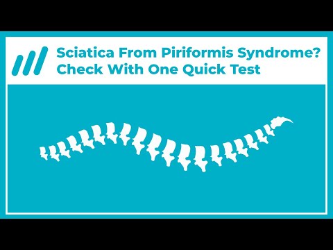 Sciatica? Piriformis Syndrome? Check With One Quick Test!