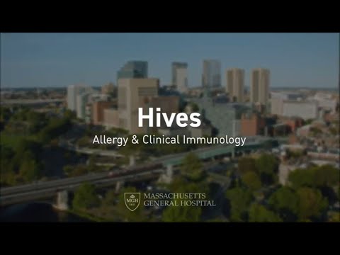 Hives