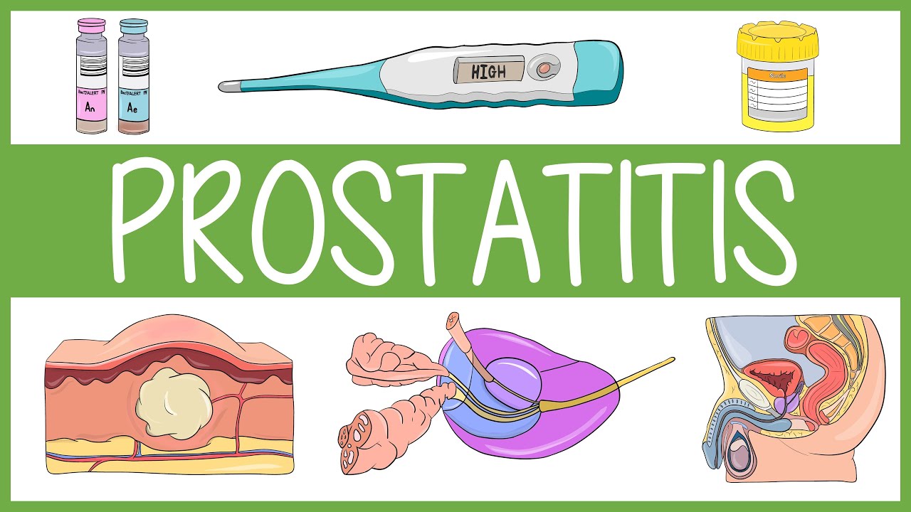 Prostatitis Visually Explained