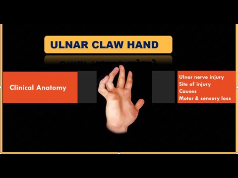 ULNAR CLAW HAND – Anatomy QA