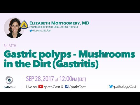 Gastric polyps - Mushrooms in the dirt (GASTRITIS)