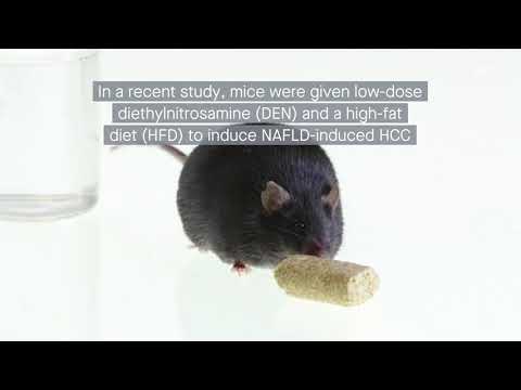 Nonalcoholic fatty liver disease is worsened by dasatinib and quercetin