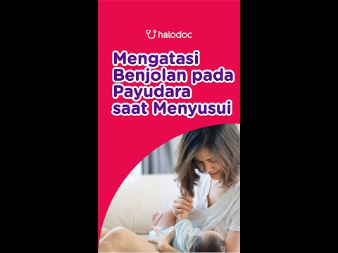 Atasi benjolan payudara saat menyusui dengan 5 cara ini. #shorts