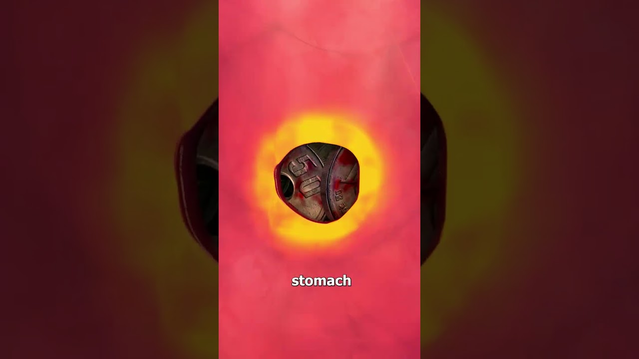 He Swallowed 1,894 Coins 😳