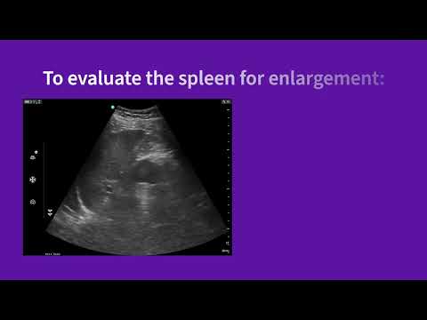 Vscan Air™ | Using presets for evaluations: spleen