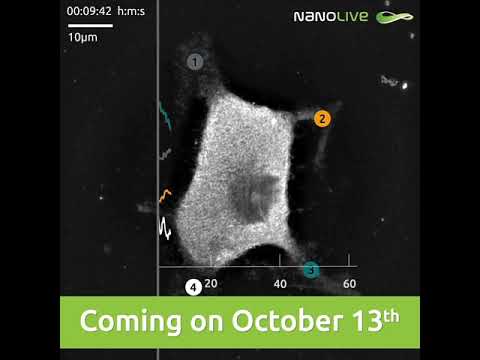 Unlocking the mysteries of neurite growth in primary cortical neurons: a quantitative approach