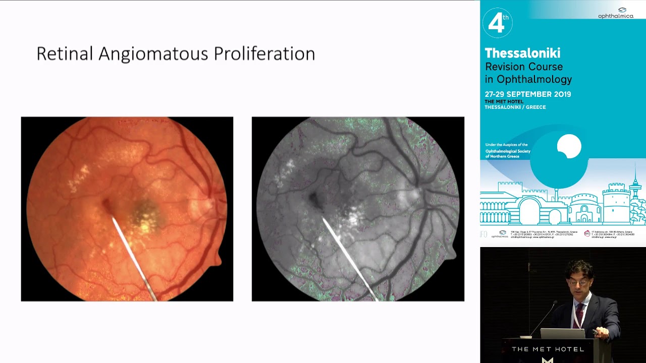 A. Tufail | Multimodal imaging retinal disease