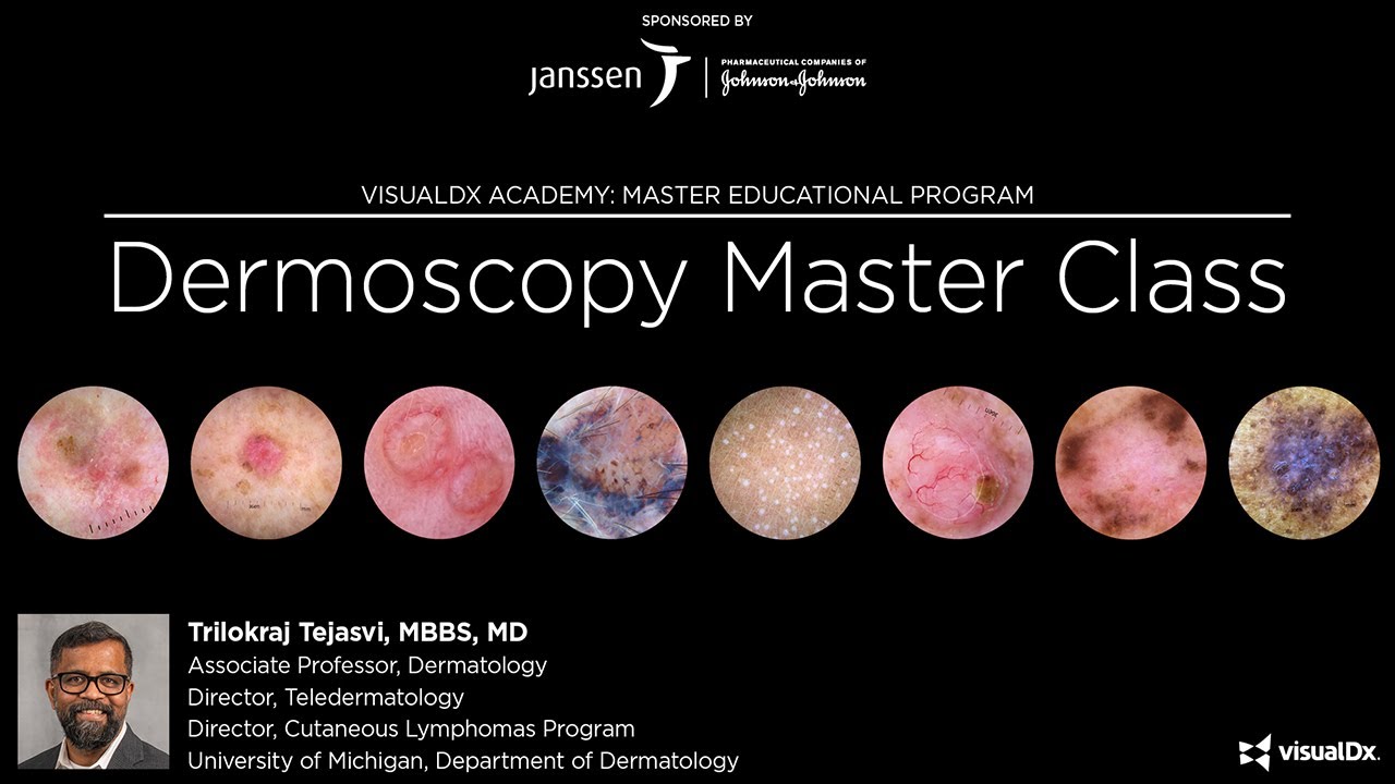 Dermoscopy Master Class