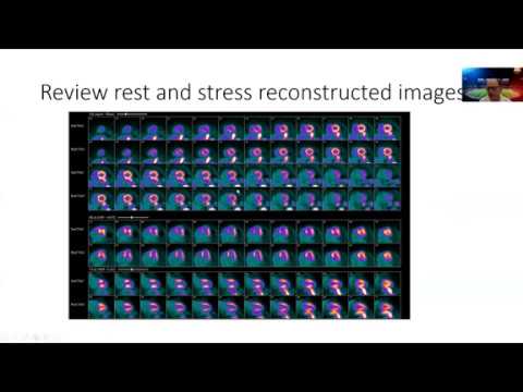 Reading Ischemia on Cardiac PET (2)