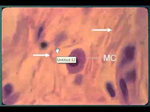 Loose connective tissue of mamory gland