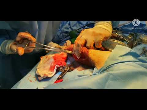 Tibial tuberosity avulsion fracture repair in a dog at All Creatures Animal Clinic
