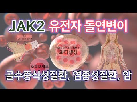 JAK2 μ μ μ λμ°λ³μ΄ - 골μμ¦μμ±μ§ν, μΌμ¦μ±μ§ν, μ