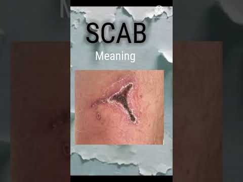 scab meaning in english with example