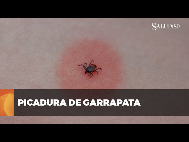 qué son las garrapatas | Salud180