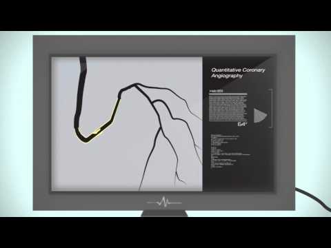 MIDAAS software for Interventional Cardiologist