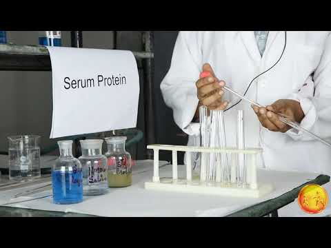 Biochemistry_Estimation of Serum Protein_Dr Ashlesha Jambure