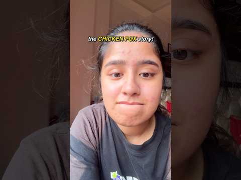 the CHICKEN POX story!???????? #minivlog #dayinthelifeofamedstudent