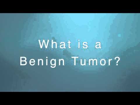 What is a benign tumor?