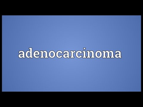 Adenocarcinoma Meaning