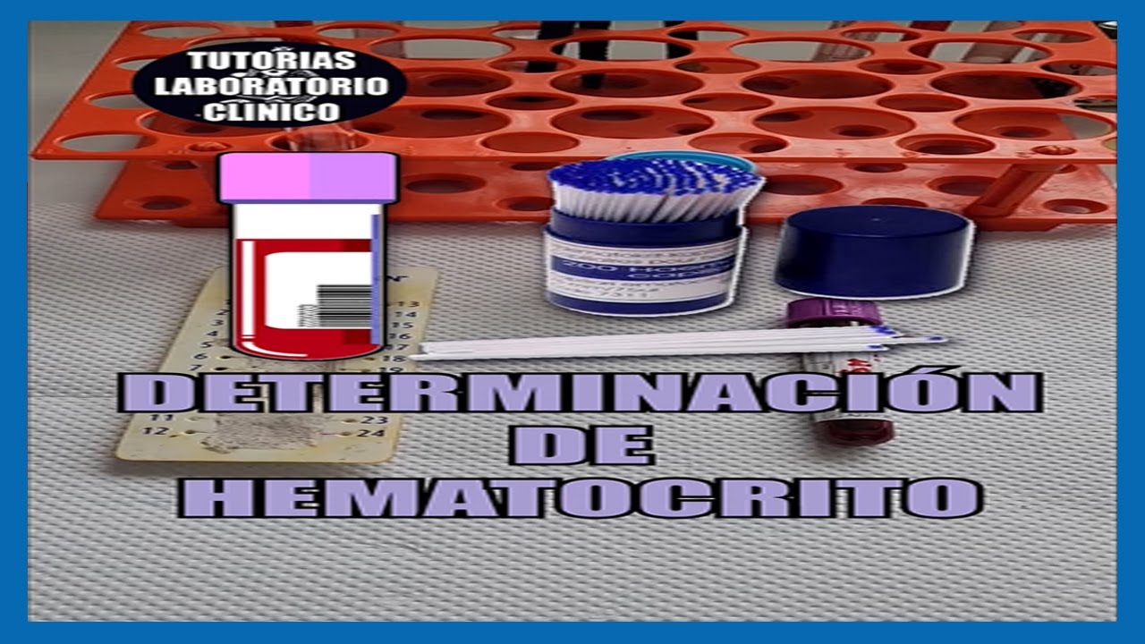 🩸Como Hacer la DETERMINACIÓN DE HEMATOCRITO por Micrométodo Manual (Hemograma completo)💉