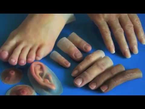 Artificial Fingers - Prosthetic Fingers Latest Price, Manufacturers ...