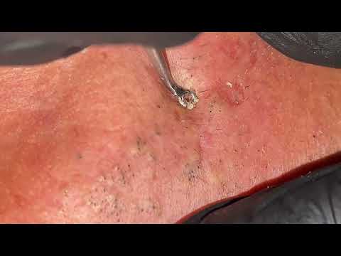 Skincare satisfying videos by Mahmoud Gamal #2008