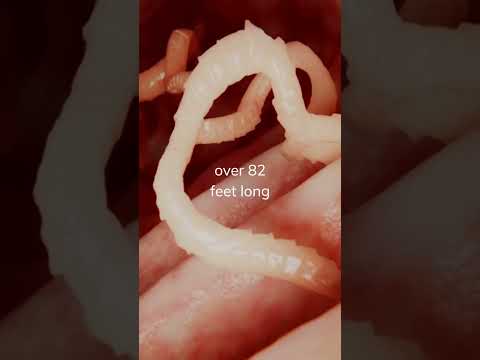 The longest tapeworm ever found in a human was over 82 feet long #shorts