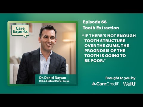 Tooth Extraction with Dr. Naysan | Care Experts by CareCredit