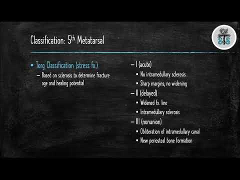 5th Metatarsal Fracture