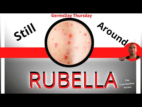 RUBELLA | German measles | 3 Day Measles ??? What are those??????