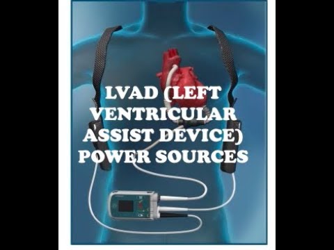 LVAD LEFT VENTRICULAR ASSIST DEVICE POWER SOURCES