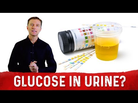 Dangers of Glucose In Your Urine – Dr.Berg
