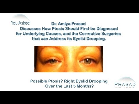 The Importance of Diagnosing the Cause of Ptosis, and the Detailed Surgical Procedures to Correct It