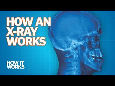 How An X-ray Works