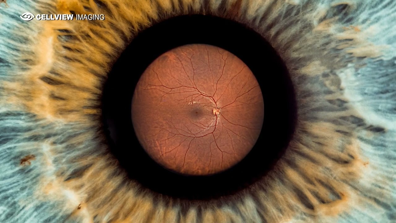 Essilor Instruments CellView