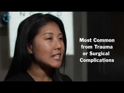 Ask the Expert: Dislocated Intraocular Lens