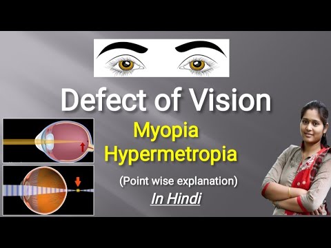 Defects of Vision | Myopia | Hypermetropia | Presbyopia | In Hindi