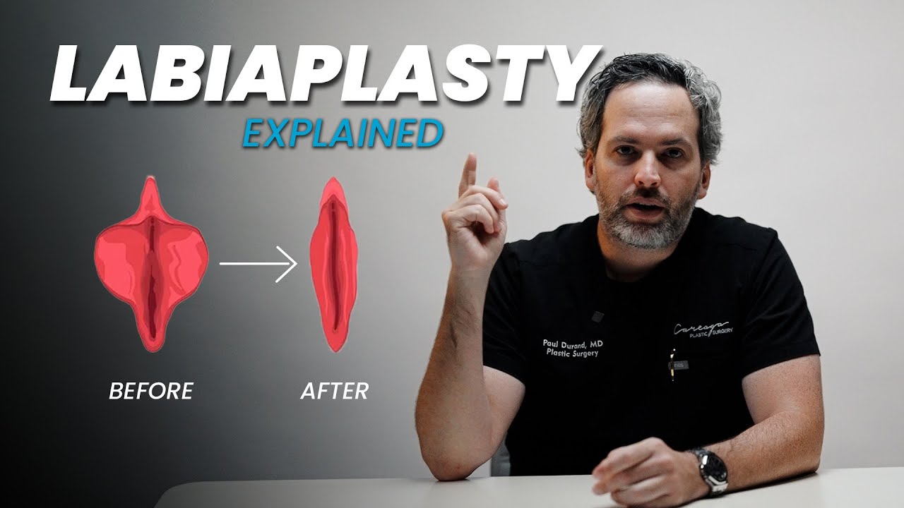Labiaplasty Explained: Reclaim Your Confidence