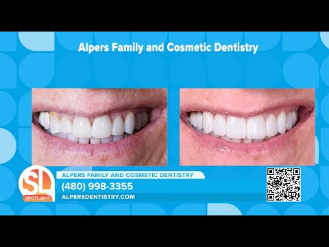 One Team. One Location. Complete Dental Care | Alpers Dentistry on ABC15
